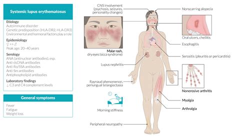 Systemic Lupus Erythematosus Knowledge Amboss 45 Off