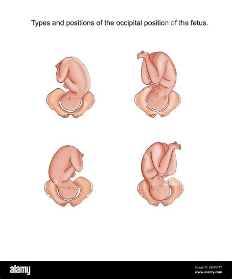 Occipital High Resolution Stock Photography And Images Alamy