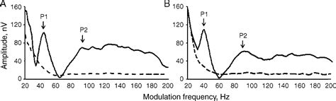 Electrophysiological Characterisation Of Envelope Following Responses Acta
