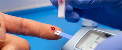 Everything You Need To Know About The Fasting Plasma Glucose Test