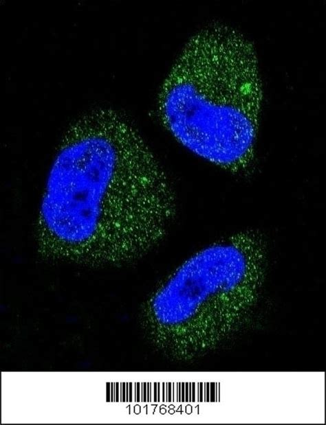 Hspa5 Antibody Cat No 57 011 Prosci