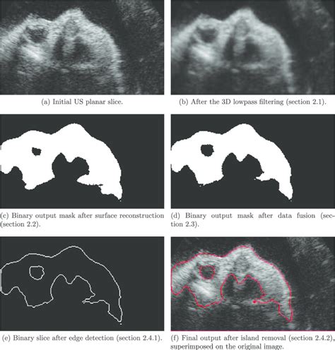 Example Of The Output Of The Different Steps The Segmentation Of The Download Scientific