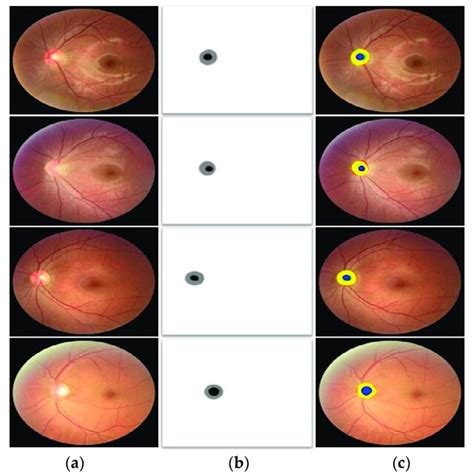 Good Oc And Od Segmentation Qualitative Results On The Refuge Database