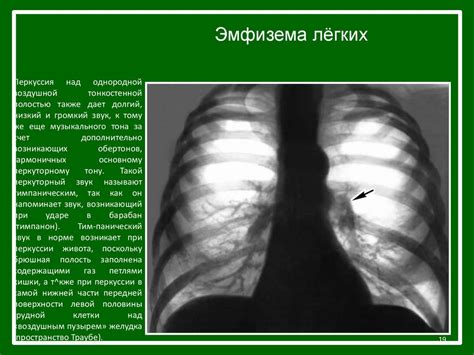 Атлас рентгеновских снимков с описанием - презентация онлайн