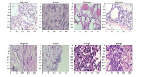 Convolutional Neural Network For Breast Cancer Classification Kdnuggets