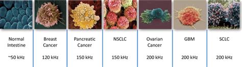 Ttfields Effects On Cancer Cells Are Frequency Specific Download Scientific Diagram