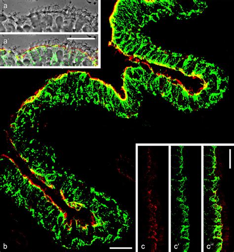 Confocal Laser Scanning Double Label Immunofluorescence Microscopy Of A