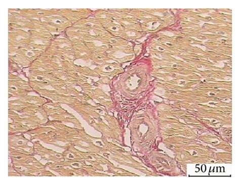 Vg Staining Analysis A Con Group Arteriole ×200 B Sf 3h Group