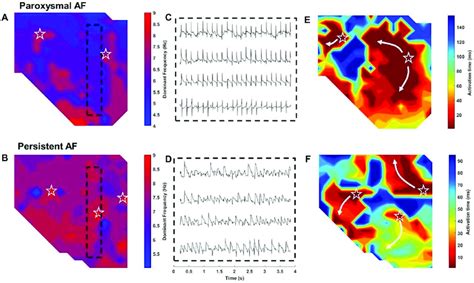 high resolution spatial mapping of dominant frequency two dimensional