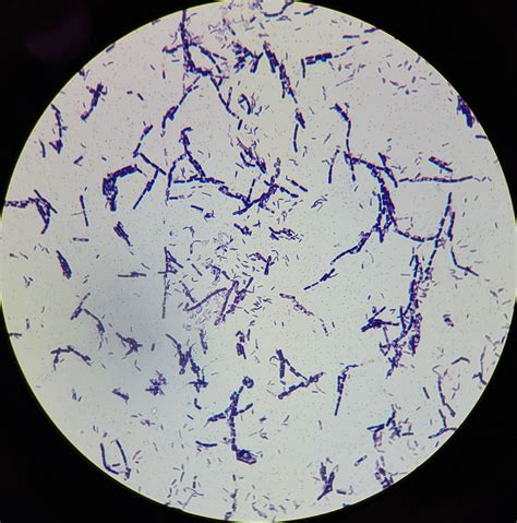 Li Gram Stain