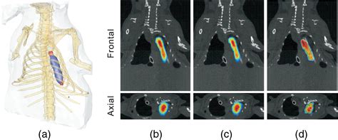 Mesh Based Monte Carlo Method In Time Domain Widefield Fluorescence