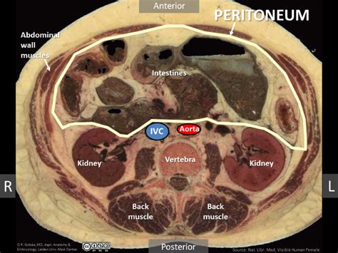 Peritonio Visceral Vs Peritonio Parietal Peritoneal Cavity