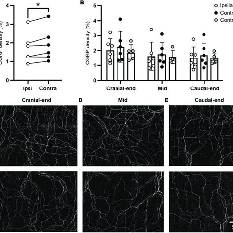 Measurements Of Cgrp Expressing Uterine Nerve Fiber Characteristics Download Scientific Diagram