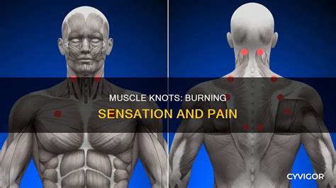 Muscle Knots Burning Sensation And Pain Cyvigor