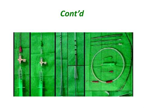 Thoracocentesis Pptx