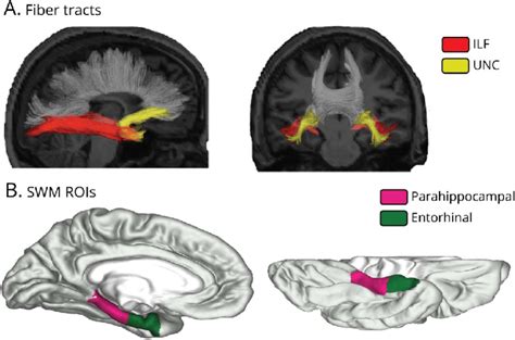 Deep White Matter Tracts And Superficial White Matter Rois Download