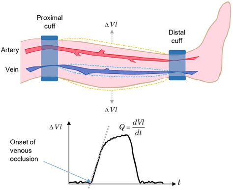 Photoplethysmography Also Known As Ppg Is A Simple And Inexpensive Download Scientific