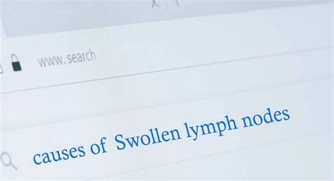 Can Bad Seasonal Allergies Cause Swollen Lymph Nodes