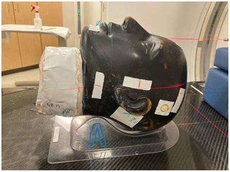 Masoud Elhamiasl On Linkedin Low Dose Computed Tomography Scanning Protocols For Online