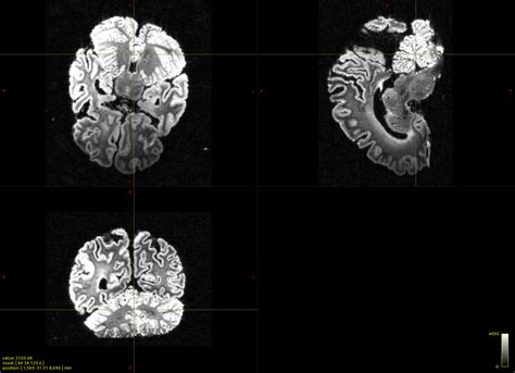 Orientations Are Wrong In Mrview With Post Mortem Data Mrtrix3 Community