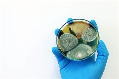 의사는 의료 건강 실험실 분석 질병에서 효모 곰팡이 및 곰팡이 페니실륨 검사를 분리하고 육성하기 위해 성장 매체에 몰트 추출물 Agar 를 사용하여 페트리 접시를 들고