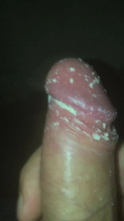 Slowly Lick And Taste My Smegma Uncut Cock Gay Couple Porn Xhamster