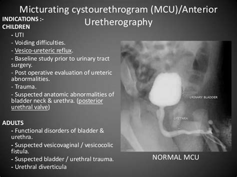 Micturating Cystourethrogram Medical Imaging Learning Facebook
