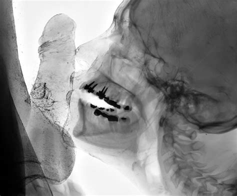 Gay Sex Intercourse X Ray Diagram Cumception