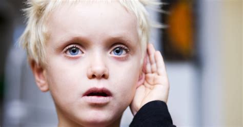 Gehoorverlies Groot Bij Kinderen Met Hiv De Morgen