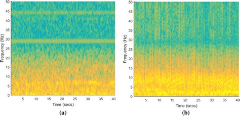 Spectrogram Of Eeg Signal A Healthy And B Epileptic Seizure Download Scientific Diagram