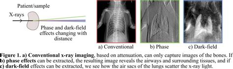 Impact Medical Imaging On Linkedin Impact Synergy Grant Research Seminar Series Thurs 30