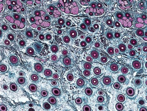 Scalp Skin Light Micrograph Stock Image P720 0234 Science Photo Library