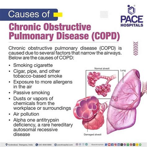 What Is Severe Chronic Obstructive Pulmonary Disease