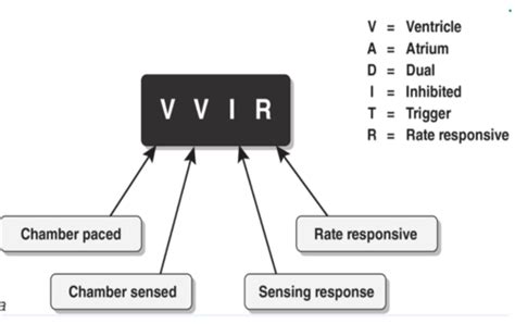 Pacemakers By Ellie Lol Flashcards Quizlet