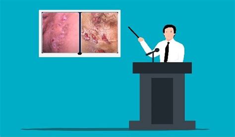 엉덩이 종기 항문 사타구니 종기 원인 Ft 엉덩이 통증 화농성 한선염 네이버 블로그