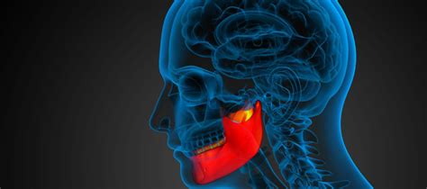 Predicting Improvement In Temporomandibular Disorders