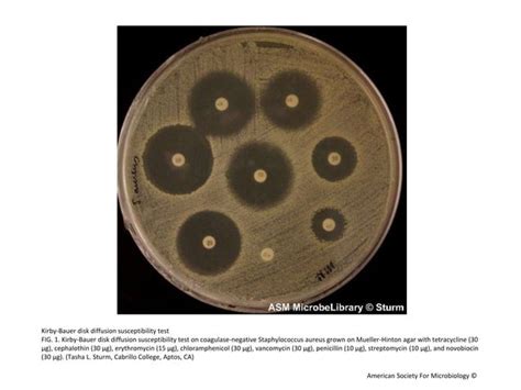 Kirby Bauer Disk Diffusion Susceptibility Test Pptx