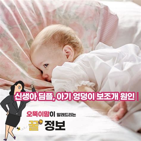 신생아 아기 엉덩이 딤플 엉덩이 보조개 원인척추이분증 네이버 블로그