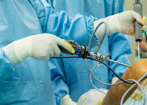 Arthroscopic Stabilization Surgery Shoulder Instability Austin