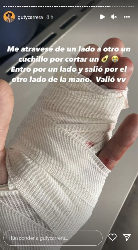 Guty Carrera se sometió a una cirugía de emergencia luego de accidentarse con un cuchillo Infobae