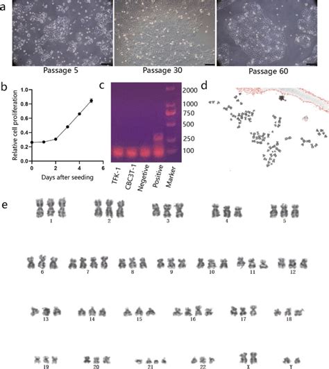 A Novel Hilar Cholangiocarcinoma Cell Line Cbc3t 1 Creative Bioarray