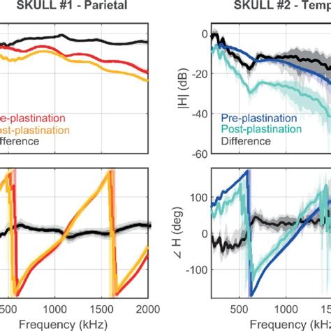 Typical Results Obtained For Attenuation Top And Phase Content Download Scientific Diagram