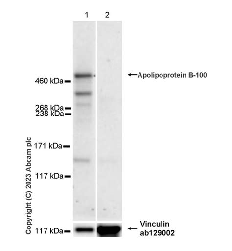 Anti Apolipoprotein B Antibody [epr27473 49] Ab312318 Abcam