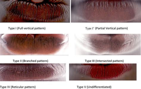 Classification Of Lip Print Patterns Of Nigerian Ibo And Hausa Ethnic