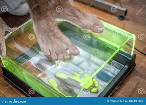 Posture And Equilibrium Analysis Stock Image Image Of Patient Pace 103262133