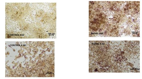 Can You Recommend A Trap Staining Kit Researchgate