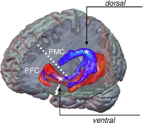 Figure 2 From Anatomy And Tractography Of The Language Tracts The