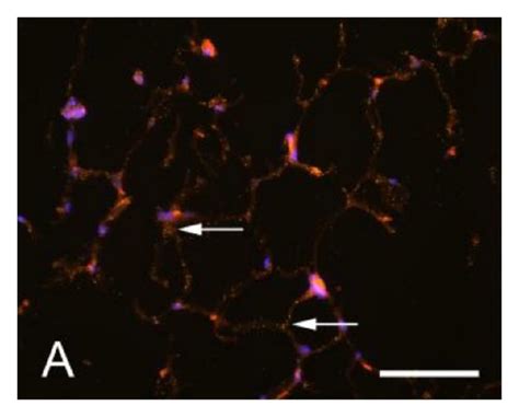 Duolink Proximity Ligation Assay To Detect Interactions Between Ptpip51 Download Scientific