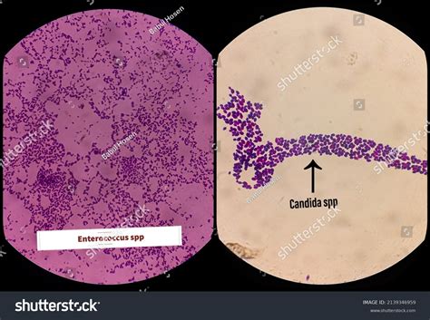 Enterococcus Faecium Gram Stain