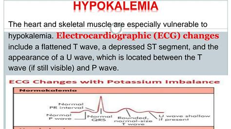 Hypo Hyperkalemia Youtube